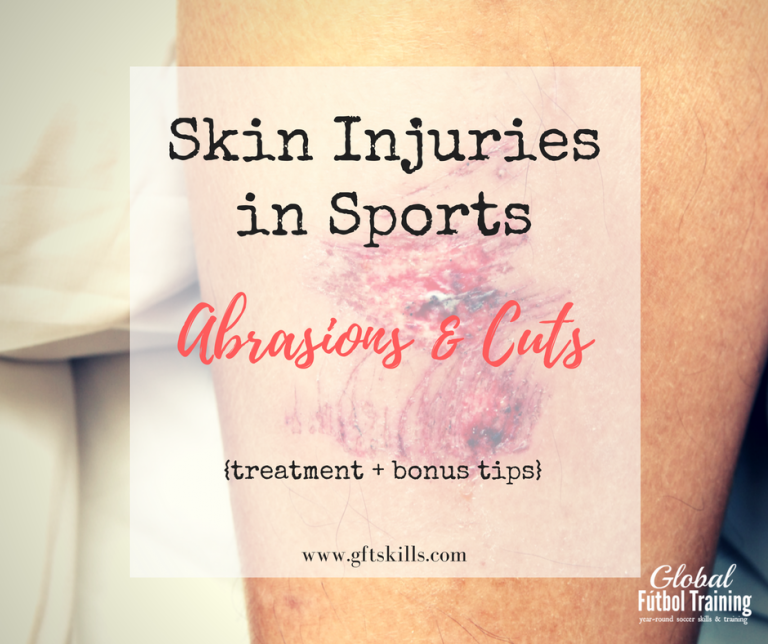 Skin injuries in sports [here's what you need to know] - video